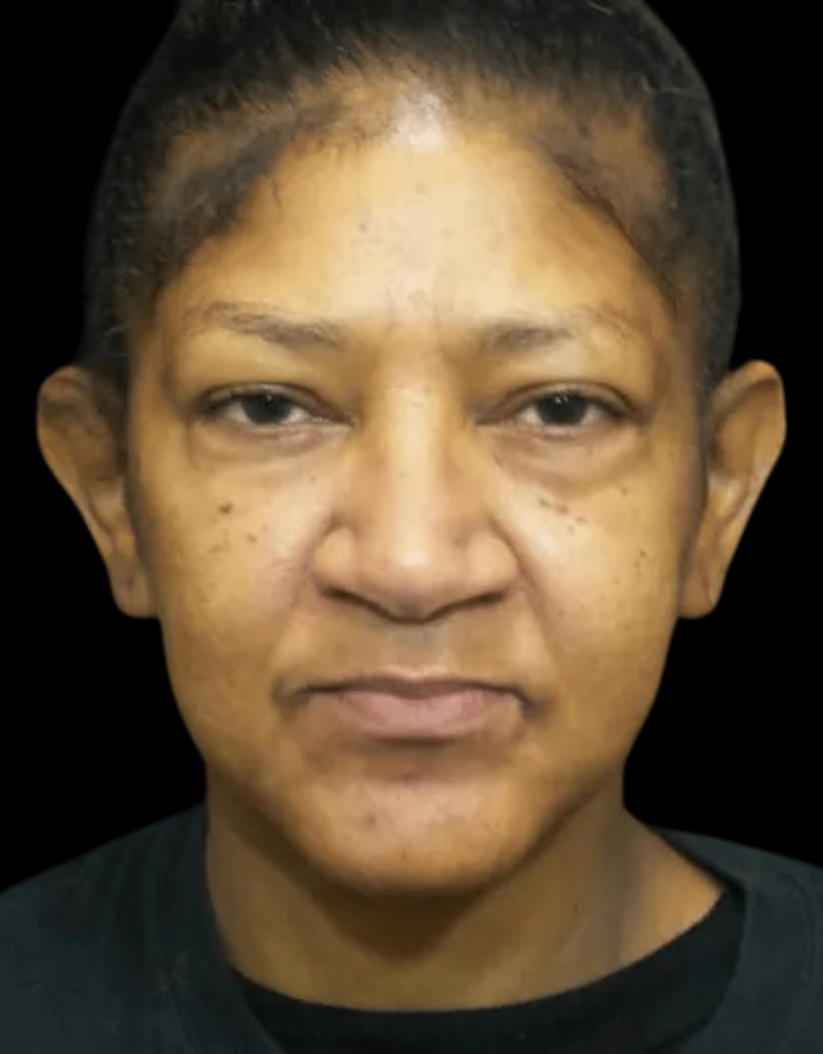 REFRESH - RE•LIFT™ Me